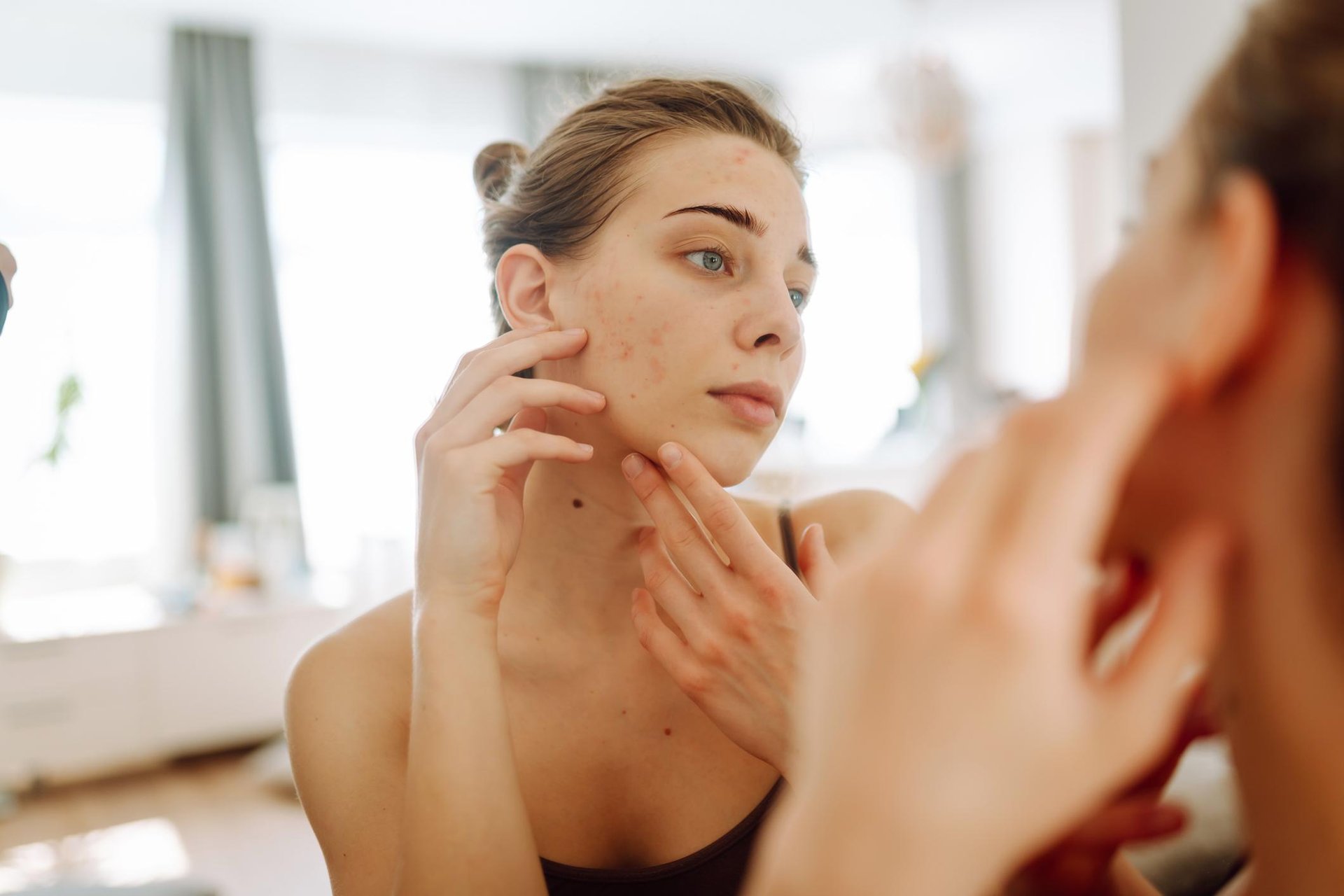 Whiteheads loswerden: Tipps für reine Haut | La Roche Posay